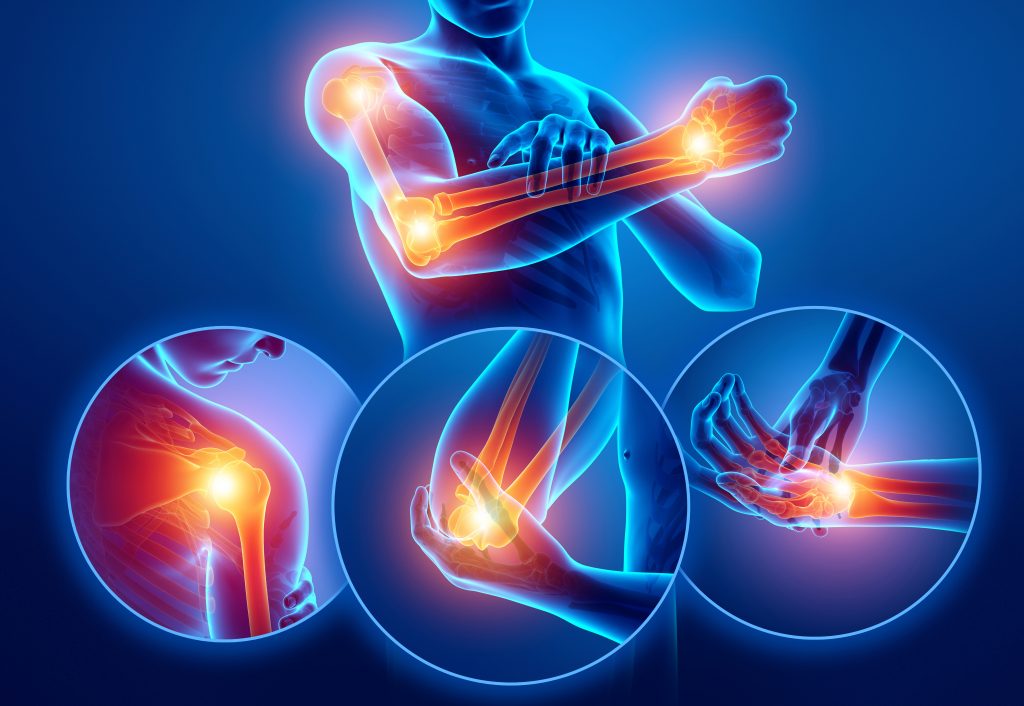 La pharmacie Torani et Haddad-Polyarthrite rhumatoïde